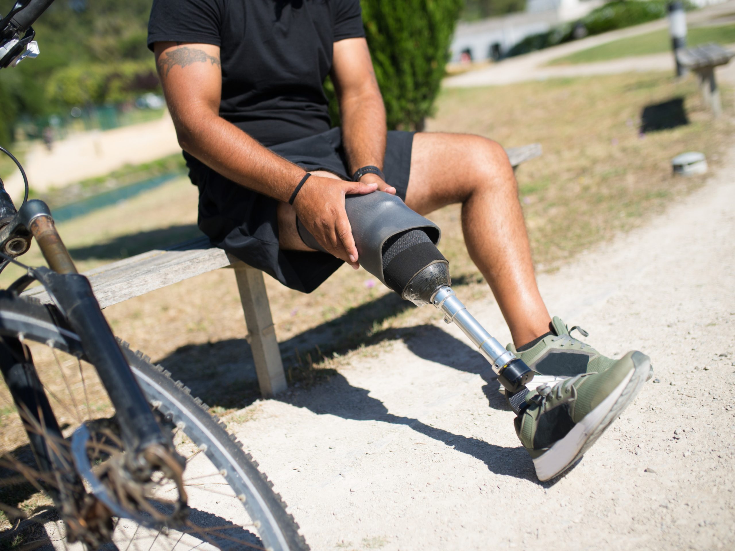 Amputation Injury Lawyers | Price Slater Gawne